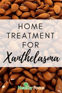 9 Home Remedies for Xanthelasma - Healthy Focus