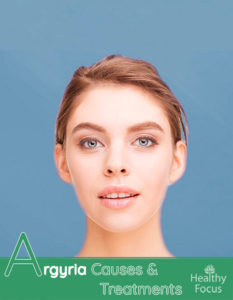 Argyria Causes and Treatments - Healthy Focus