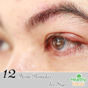 12 Home Remedies for Styes - Healthy Focus